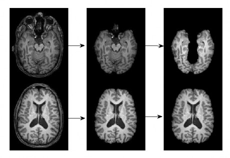 MRI of the Human Brain - College of Sciences